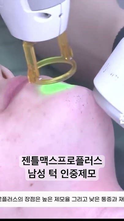 젠틀맥스프로플러스 남성 턱 인중제모 4k 동영상 레이저제모 남자제모 제모 Youtube