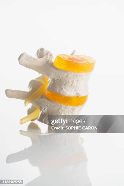 Caisson Disease Photos And Premium High Res Pictures Getty Images