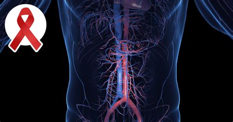 Video Early Diagnosis Of Vasculitis Critical For Avoiding Damage