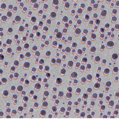 Microscopy Image Segmentation At Troy Musselman Blog