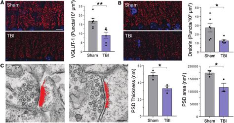 Synaptic Alterations In The Hippocampus Of Tbi Inoculated Mice A And