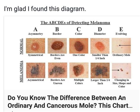 Mole Id Red Moles Mole Cancerous Moles