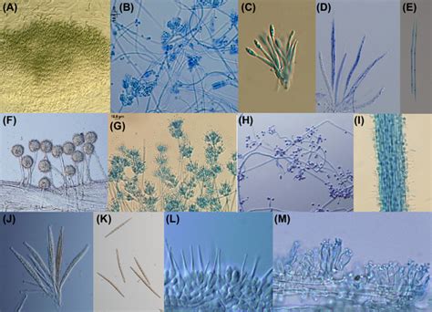 Ascospores Under Microscope