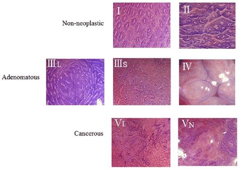 Kudos Pit Pattern Classification Was Composed Seven Type Pit Pattern