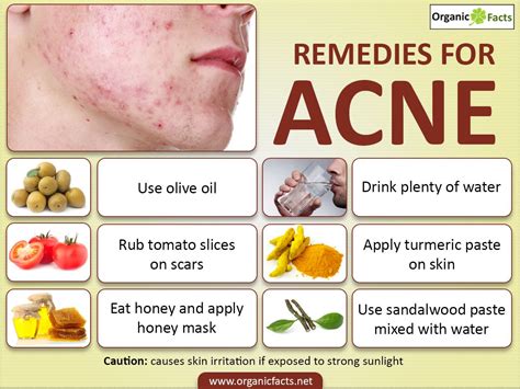Home Remes For Acne Pimples And Blackheads Homemade Ftempo
