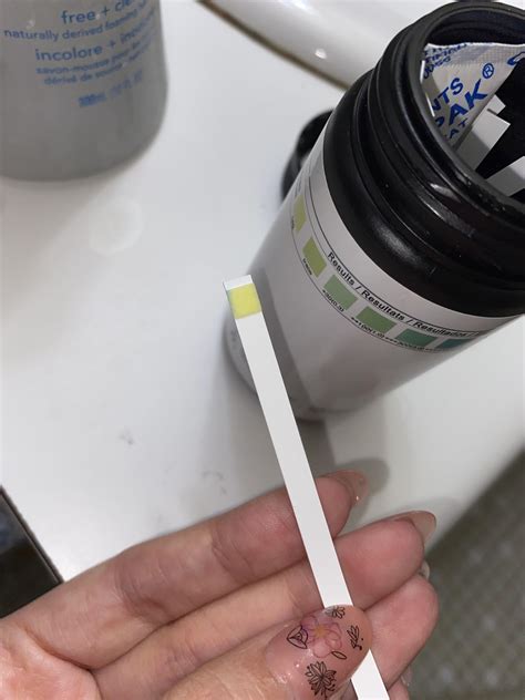 Lupus Nephritis And Classes R Lupus