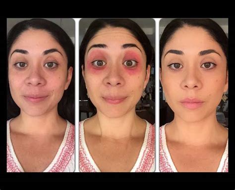 Heres A Guide To Using Red Lipstick For Colour Correction Herzindagi