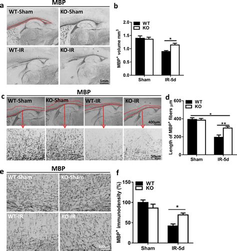 Cerebral Irradiation Interrupts Subcortical White Matter Development In