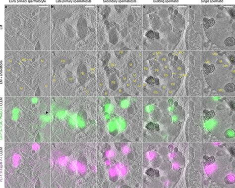 Pei Granules Are Associated With Membranous Organelles Ae