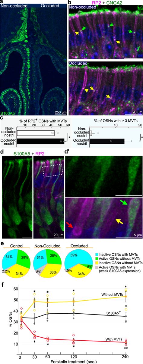 Disintegration Of The Rp2⁺ Limiting Membrane Is Inhibited By Naris