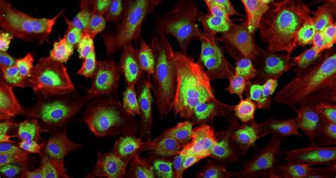 Nvidia 的 生成式ai 技術正在透過 Bionemo 模型為下一世代的藥物開發開創未來，現有多種 Ai 模型和雲端服務能推動電腦輔助 藥物探索 生態系統的發展：