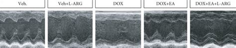 Ea Prevented Dox Induced Cardiotoxicity Through Regulating The No