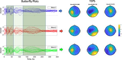 Figure 1 From The Effect Of Stimulation Frequency On Transcranial Evoked Potentials Semantic