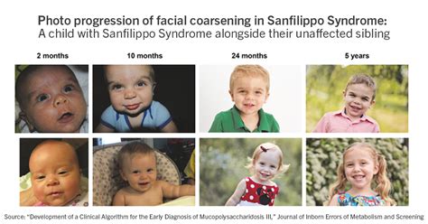 Sanfilippo Syndrome Clinical Trial Captions Pages