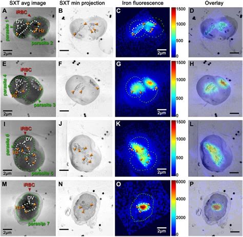 Correlative Imaging Of Plasmodium Parasites By Soft X Ray Tomography