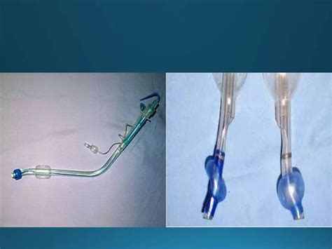 One Lung Ventilation Pptx