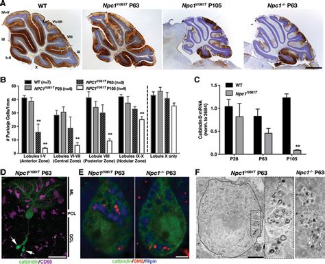 Cerebellar Purkinje Cell Neuropathology Of Npc1 I1061 Mice A Temporal Download Scientific