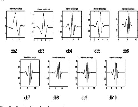 Figure 1 From Simulation For Design The Compressed Ecg Signal Transmission System With Baseline