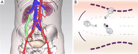 Three Dimensional Reconstruction Models Of Computed Tomography Download Scientific Diagram