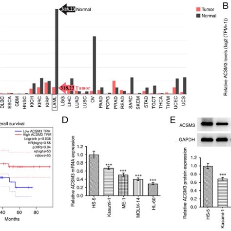 Acsm3 Is Downregulated In Aml And Is Associated With Poor Prognosis