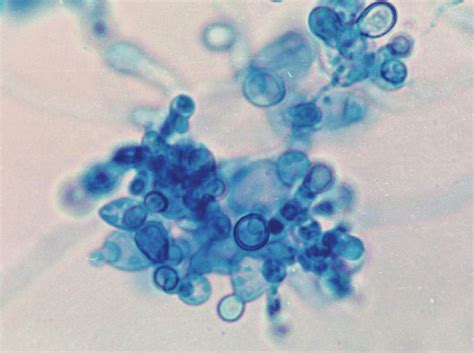 Chlamydoconidia