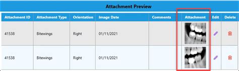 Cannot Add Duplicate Attachment File