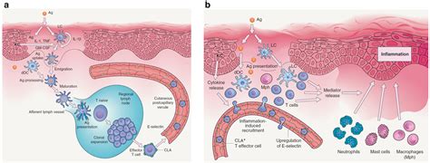 Mouse Models Of Allergic Contact Dermatitis Practical Aspects