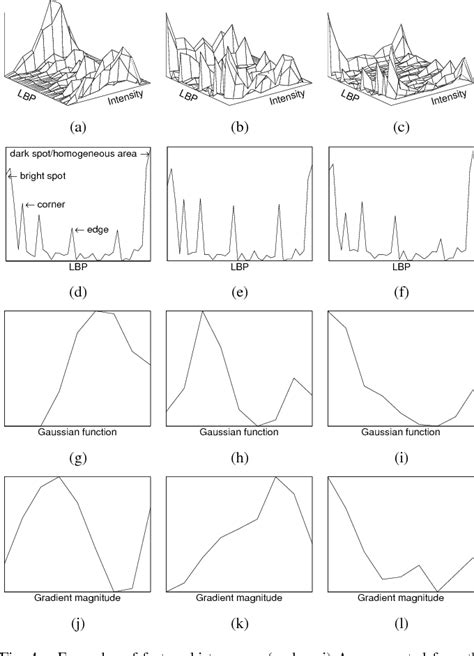 Figure 4 From Quantitative Analysis Of Pulmonary Emphysema Using Local