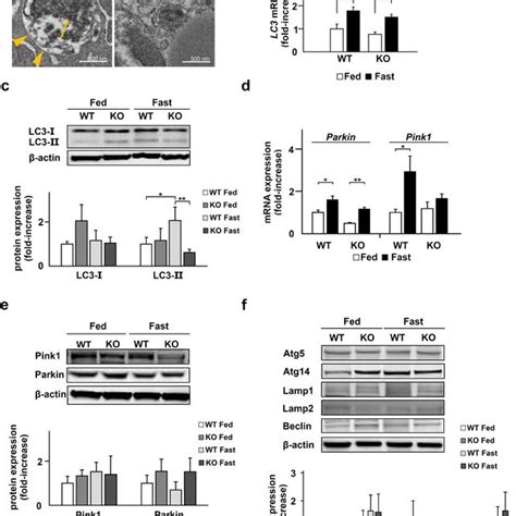 The Expression Of Txnip Is Upregulated During Fasting The Expression