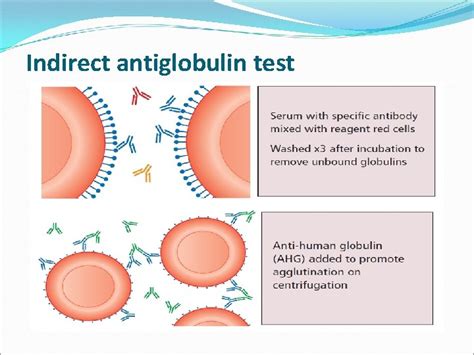 Practical Blood Bank Lab 5 The Antiglobulin Test