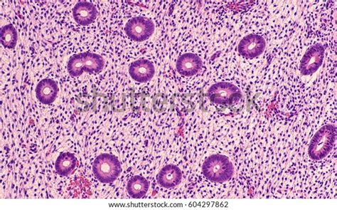 Proliferative Endometrium Histology