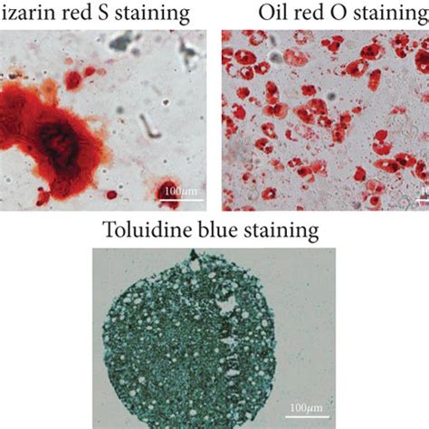 Cell Morphology Of Tendon Stem And Progenitor Cells On Tissue Culture