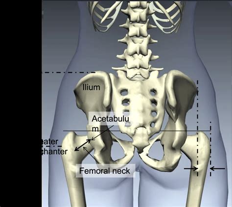Hip Dip Is Not A Problem But There Is A Real Problem Everfitsg