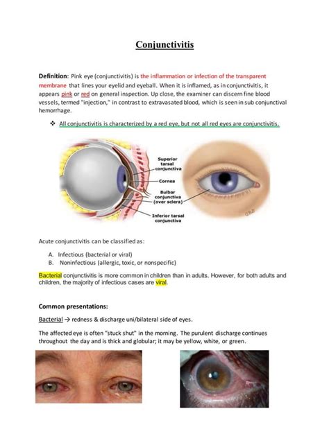 Conjunctivitisdocx Eye And Vision Conditions Diseases And Conditions