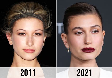 Fans React To Hailey Biebers Before And After Photos After Plastic
