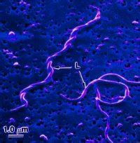 Enfermedades Infecciosas Y Microbiologia Medica Infecciones Por