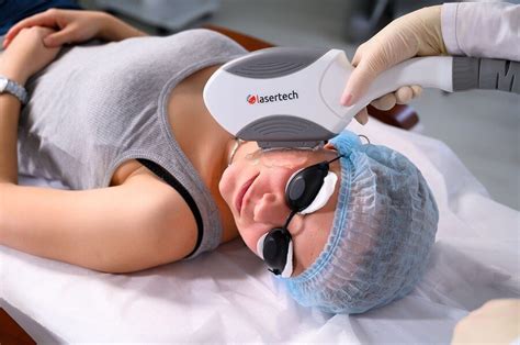 Удаление пигментных пятен на лице с помощью лазера — Teletype