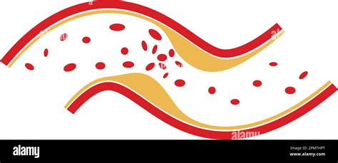 Vector Of Cholesterol Plaque Illustratrion Design Stock Vector Image And Art Alamy