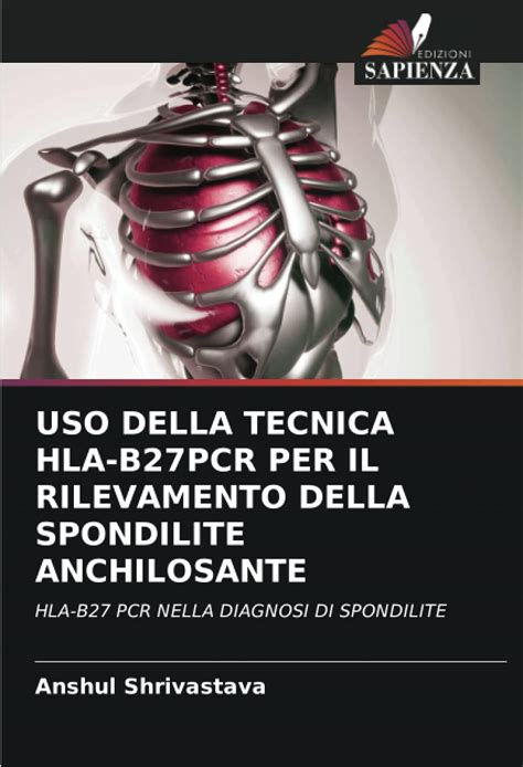 Buy Uso Della Tecnica Hla B27pcr Per Il Rilevamento Della Spondilite Anchilosante Hla B27 Pcr