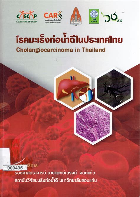 โรคมะเร็งท่อน้ำดีในประเทศไทย Cholangiocarcinoma In Thailand สำนักหอสมุด มหาวิทยาลัยขอนแก่น