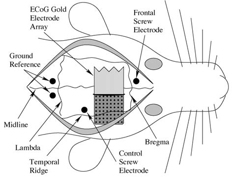 Figure 2 From Characterization Of Flexible Ecog Electrode Arrays For Chronic Recording In Awake