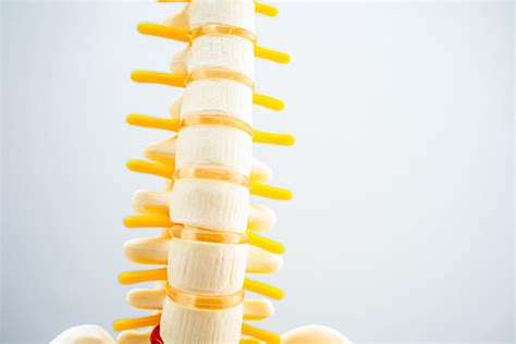 Disc Herniation Treatment What It Is And When To Get It