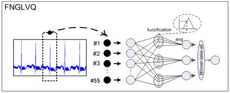 Illustration Of Fn Glvq Algorithm For Ecg Classification Download