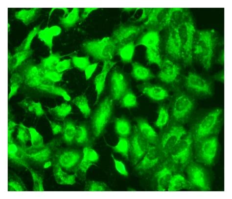 Dcfda Staining For Ros Generation Of Human Lung Cancer Cells A549 In