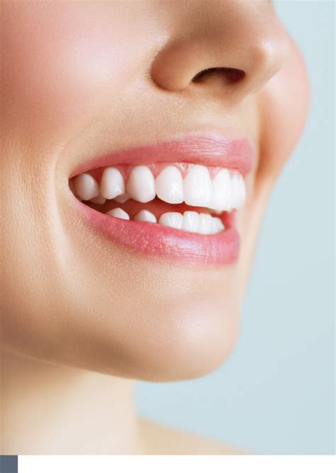 Professional Dental Cleaning Services Grinn Dental Hygiene