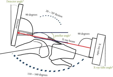 Set The X Ray Tube And Detector Angles To Be Perpendicular To The Angle