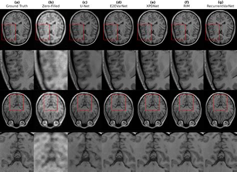 Recurrent Variational Network A Deep Learning Inverse Problem Solver Applied To The Task Of