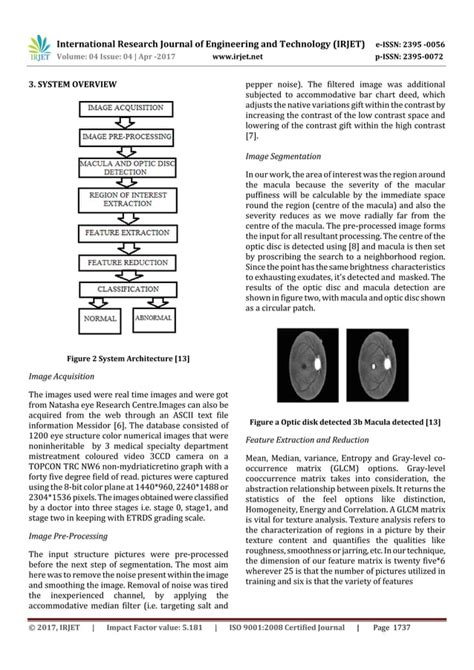 detection of macular edema by using various techniques of feature