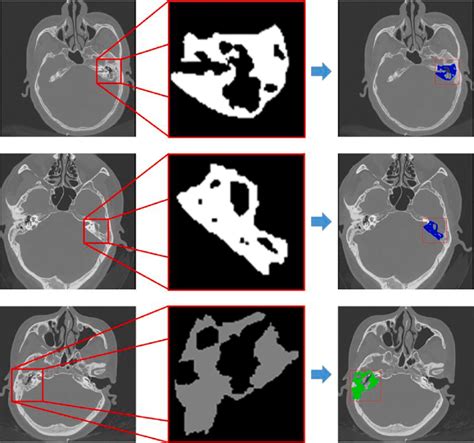 Image Preprocessing Several Preprocessing Examples Through Expert