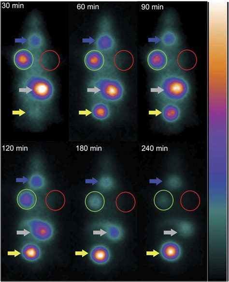 The Dynamic Imaging By Spect Instrument The Imaging Variation Over Download Scientific Diagram